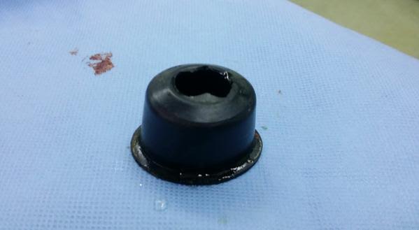 Man swallows rubber twice to lose weight - Emirates 24|7